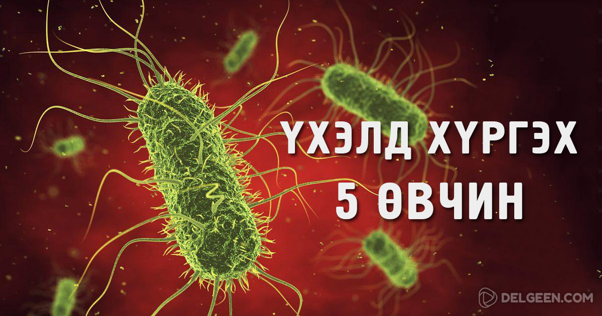 Хорт хавдар зүрхний шигдээсээс ч илүү аюултай 5 өвчин Хүмүүс эдгээрт