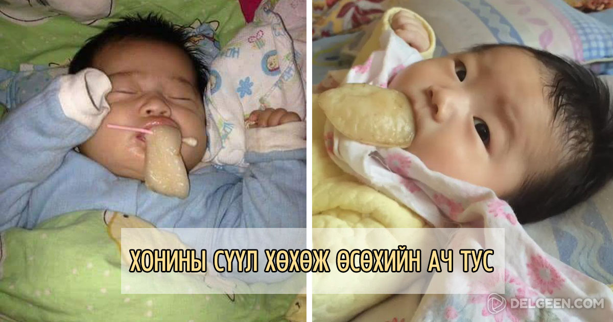 Хүүхэд хонины сүүл хөxөж өссөнөөр өлчир чийрэг өвчин эсэргүүцэх