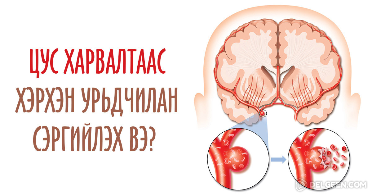 Цус харвалтаас урьдчилан сэргийлж амь насаа аврах арга Үүнийг мэдээд